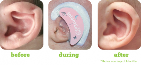 Ear Deformities | Pediatric ENT of Oklahoma